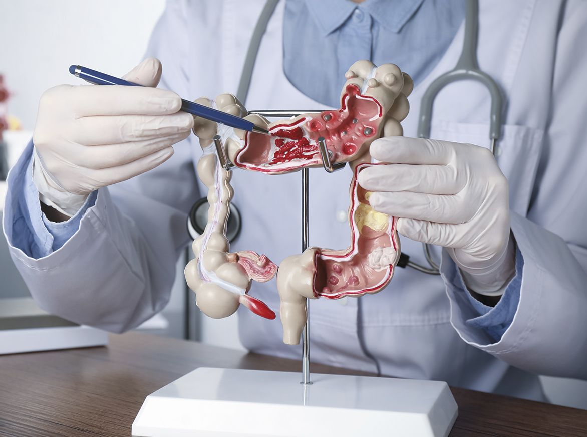 Fecale incontinentie. Een taboe aandoening die kan worden behandeld ...